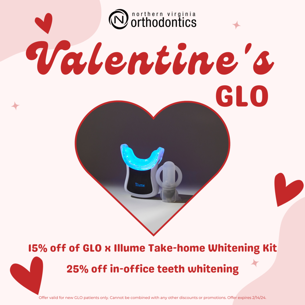 Valentine's Day GLO Teeth Whitening